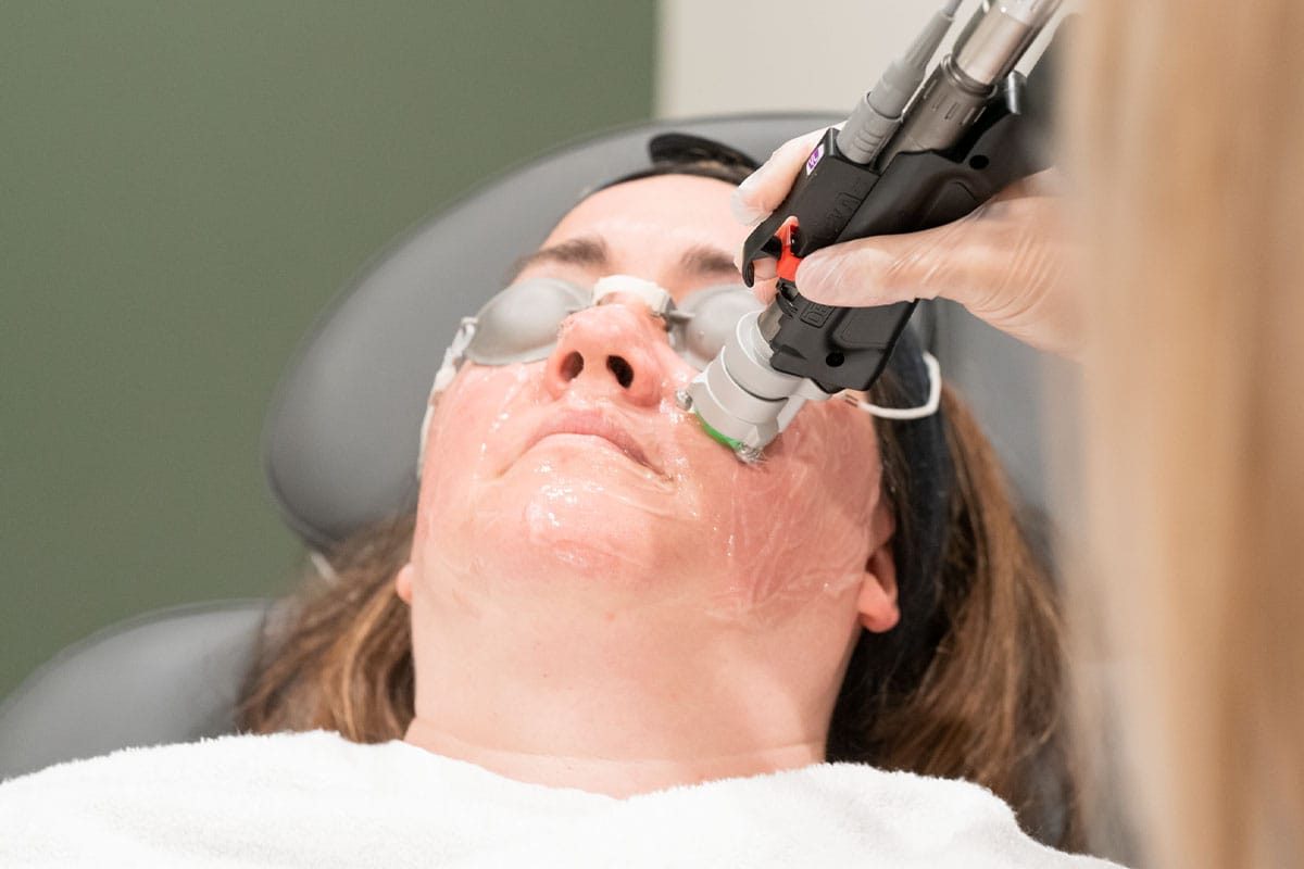 Motus AZ+ in LaGrange, GA | Willow Medical Aesthetics